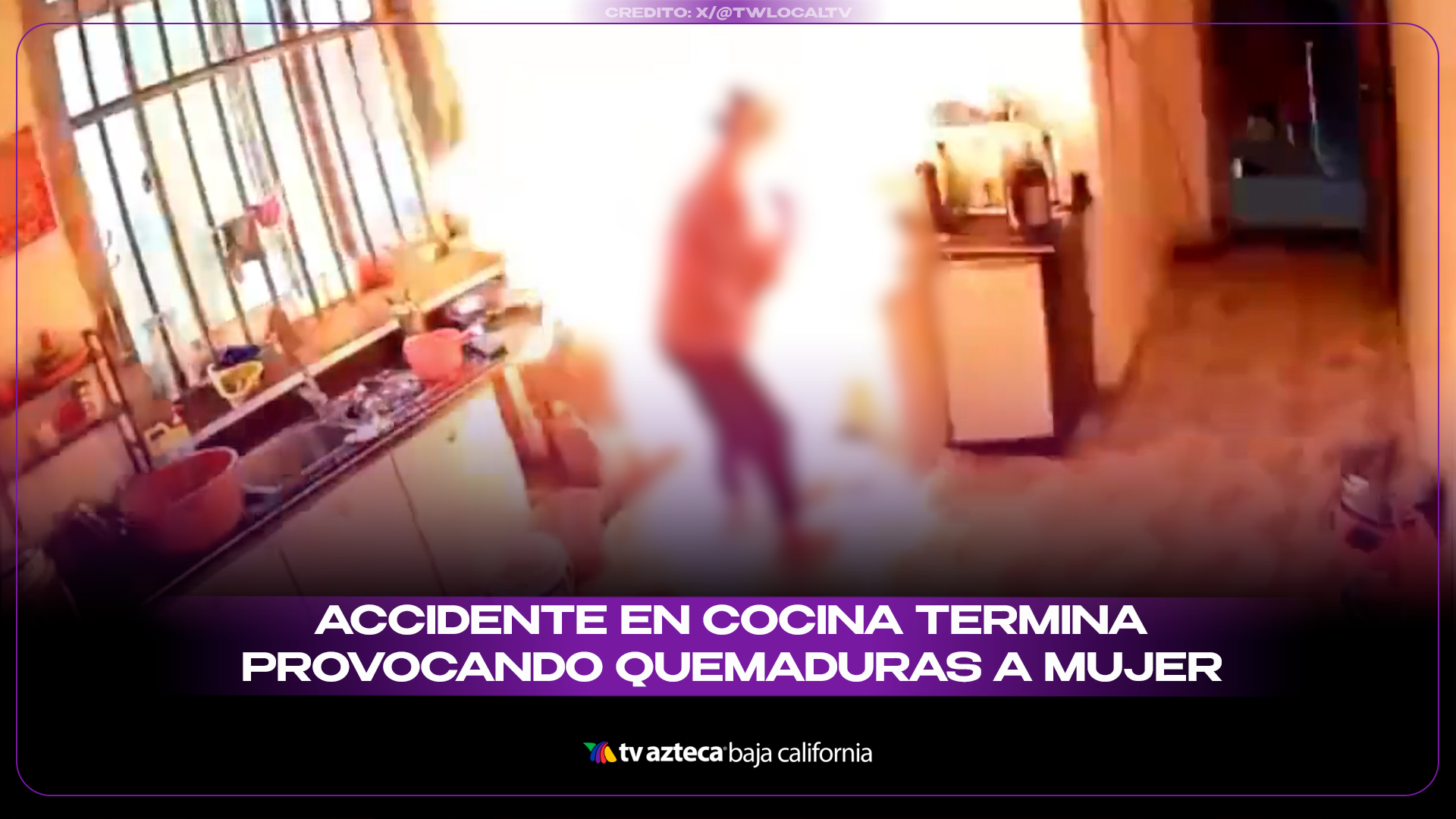 Accidente en cocina: mujer resulta con quemaduras tras flamazo al ...