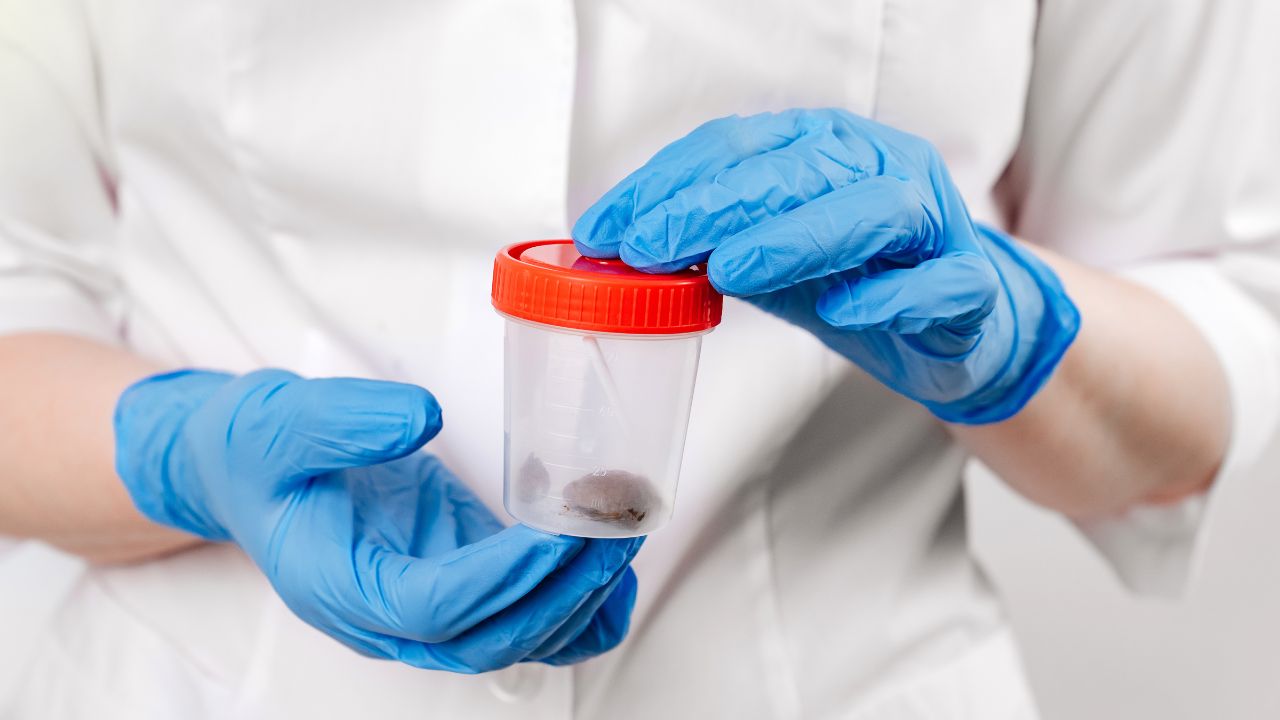 Microbiota Fecal: Trasplante de Popó Podría Salvarte la Vida