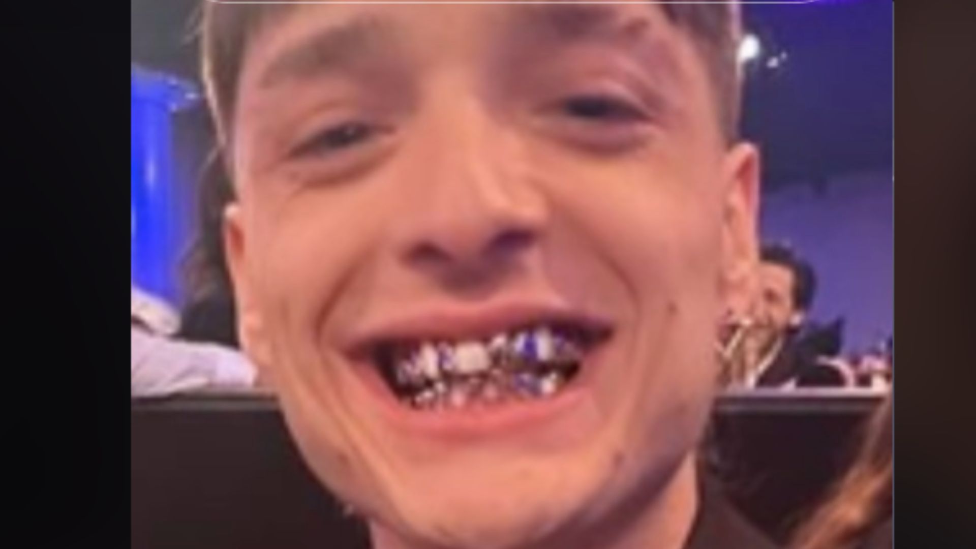 ¿Cuánto cuestan los dientes de Peso Pluma? Aquí te compartimos los ...