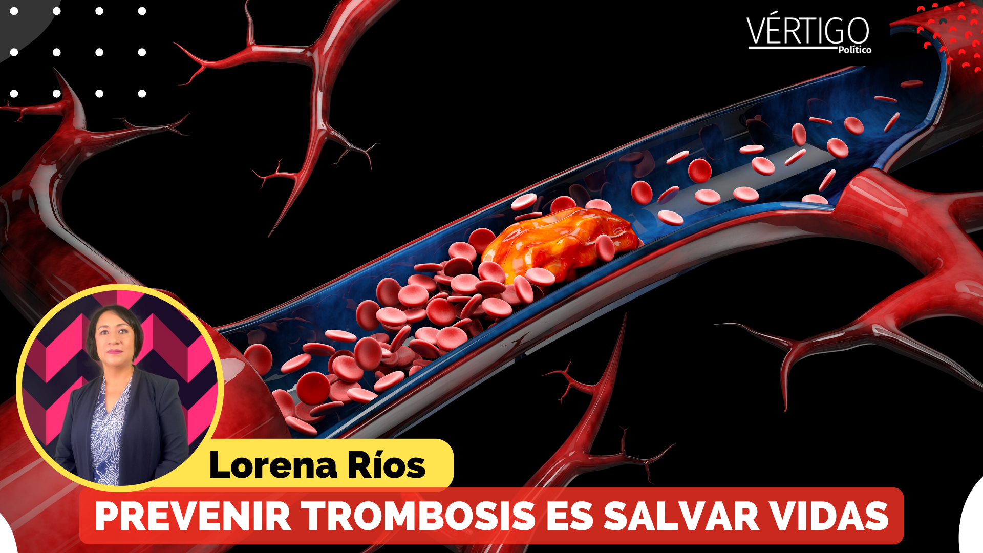 PREVENIR TROMBOSIS
