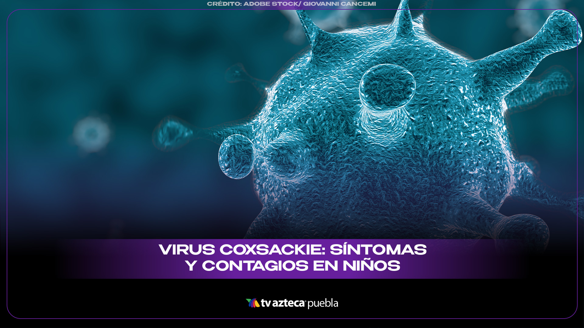 Virus Coxsackie en Puebla y Oaxaca: síntomas y medidas de prevención
