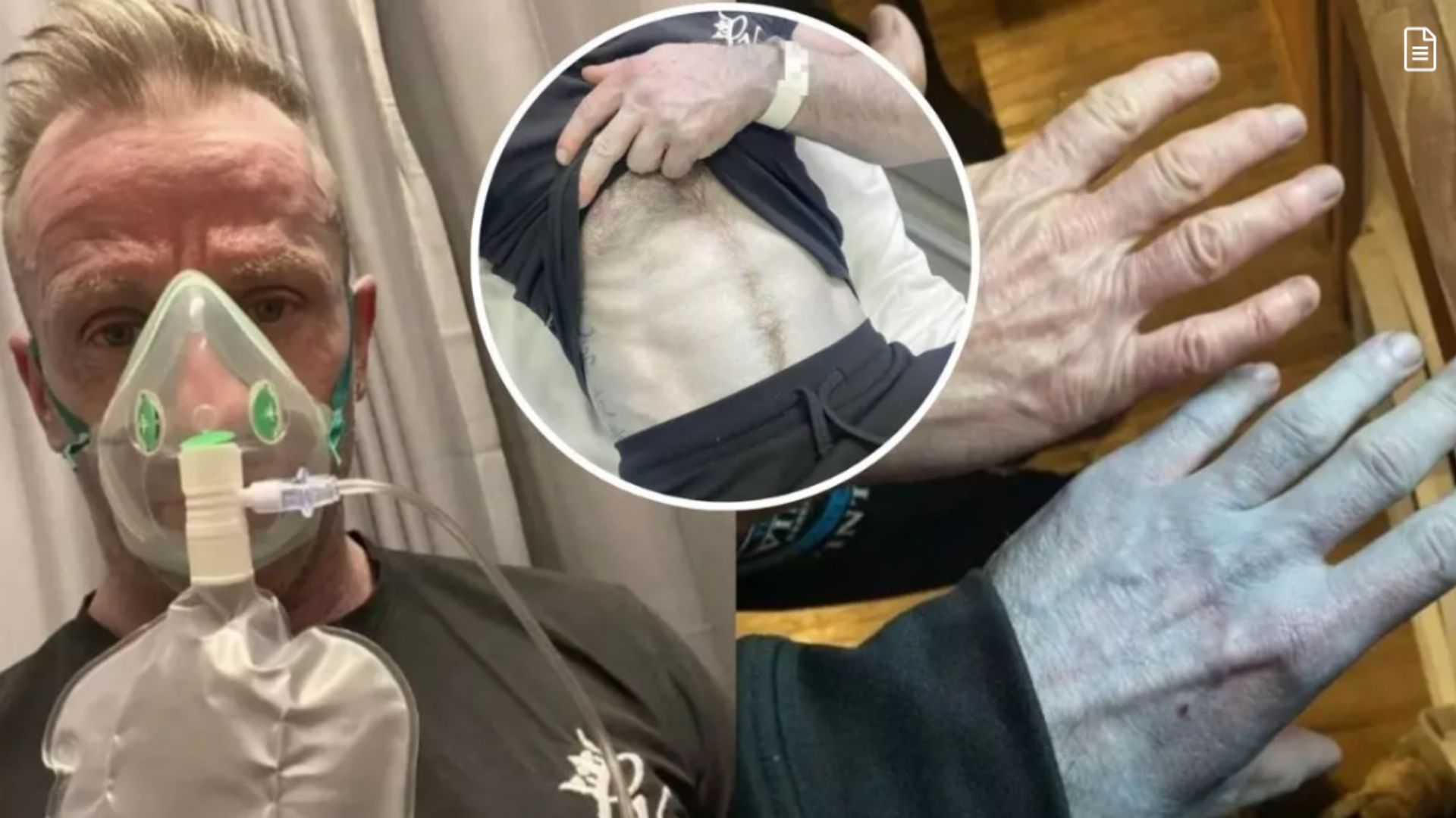 Por qué un hombre despertó con la piel azul: el diagnóstico que ...