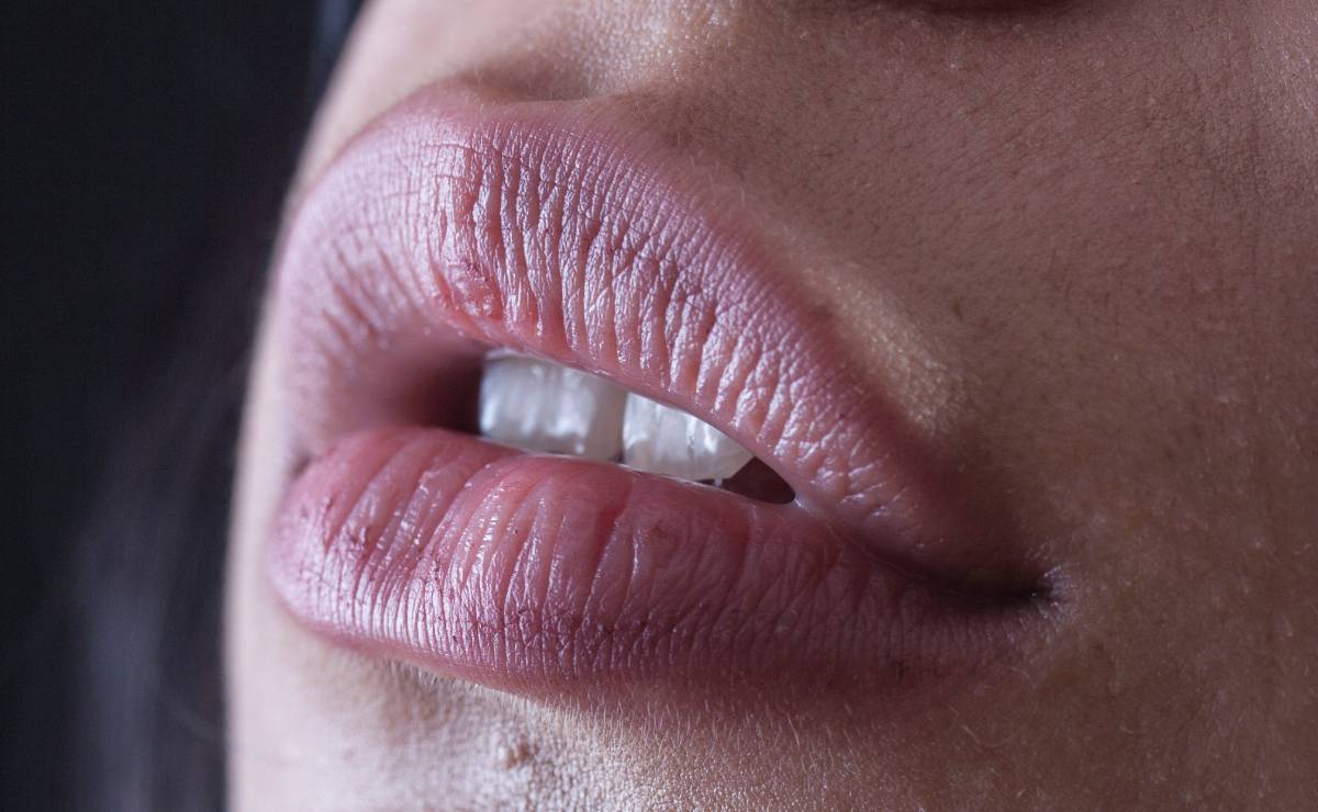Labios resecos por el frío: ¿por qué pasa y cómo evitarlo?
