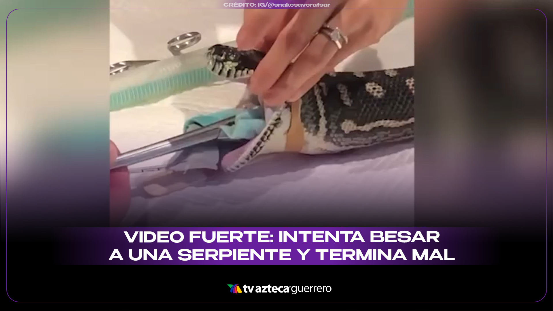 Veterinarios extraen toalla de baño del estómago de una serpiente ...