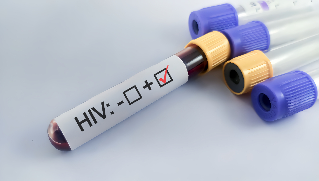 VIH en 2025: Los 5 estados con mayor incidencia en México y el primer ...