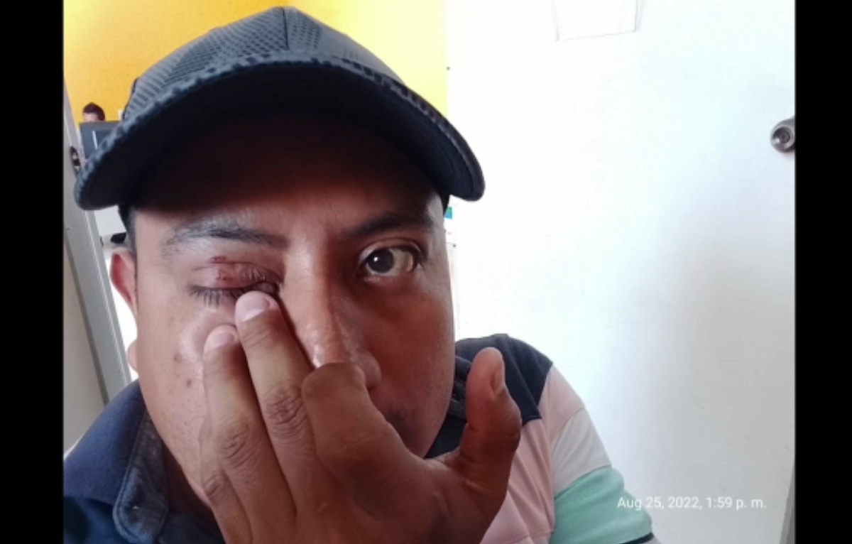 Periodista denuncia a alcalde tras golpearlo en Chiapas