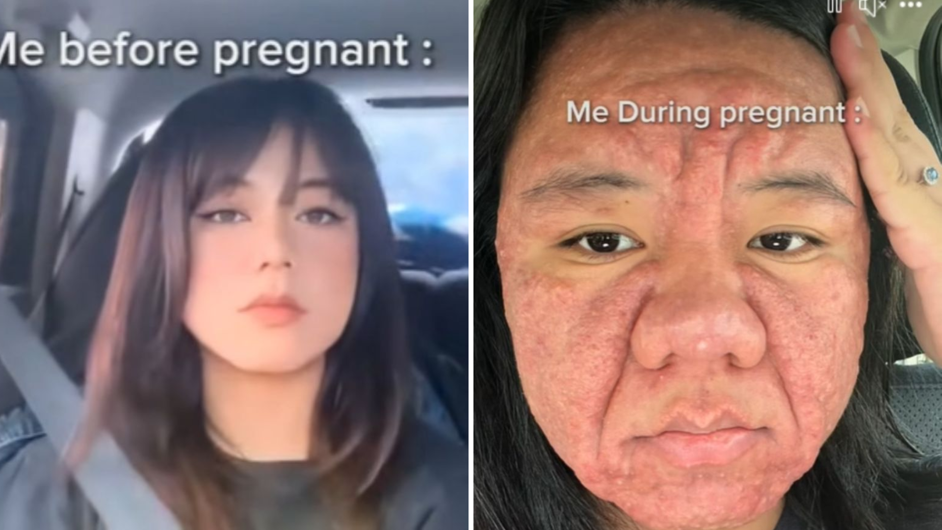 No me reconocía” Mujer embarazada sufre deformaciones en el rostro, así ...