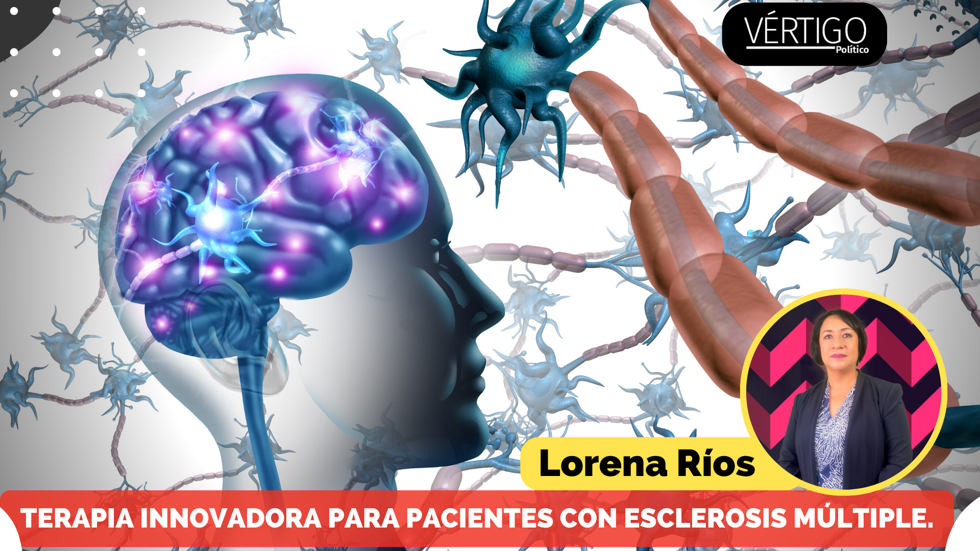 TERAPIA PARA PACIENTES CON ESCLEROSIS MÚLTIPLE
