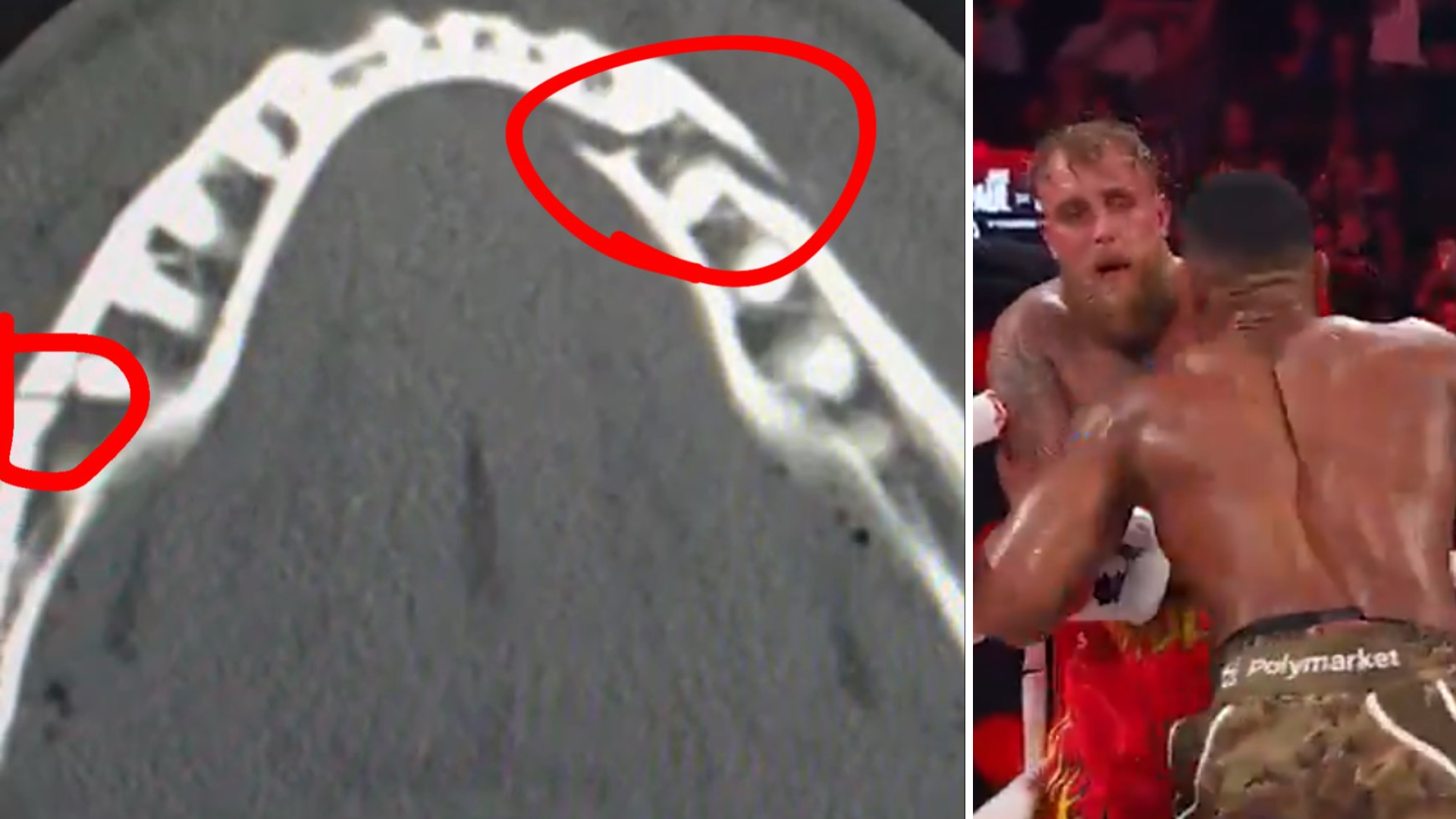 Jake Paul sufre doble fractura de mandíbula tras pelea con Anthony Joshua