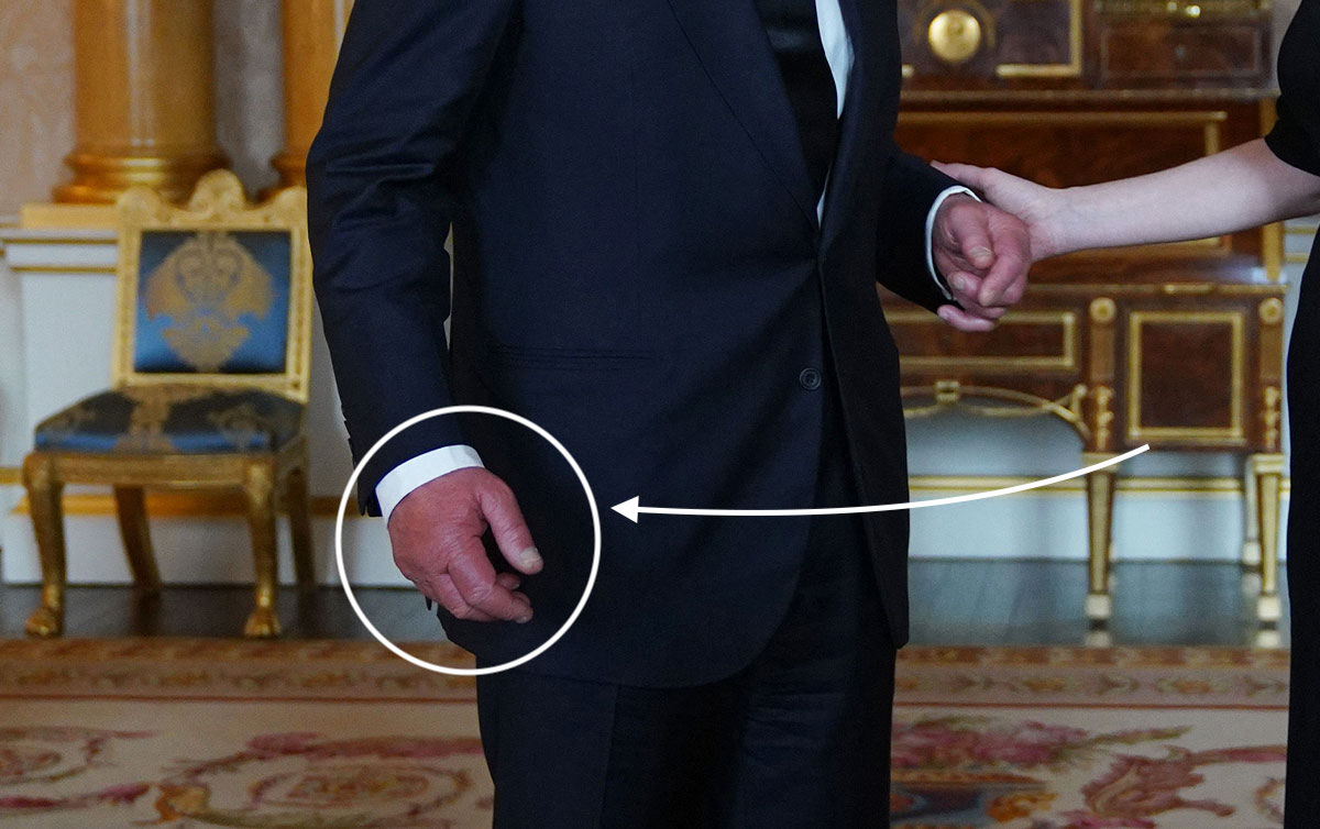 ¿Por qué el rey Carlos III tiene las manos de salchicha?