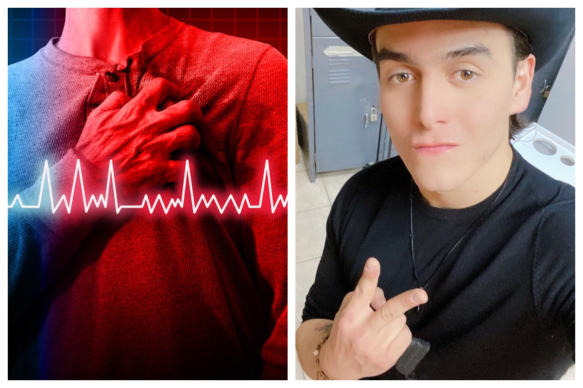 Qué es un infarto agudo al miocardio y cuáles son sus síntomas