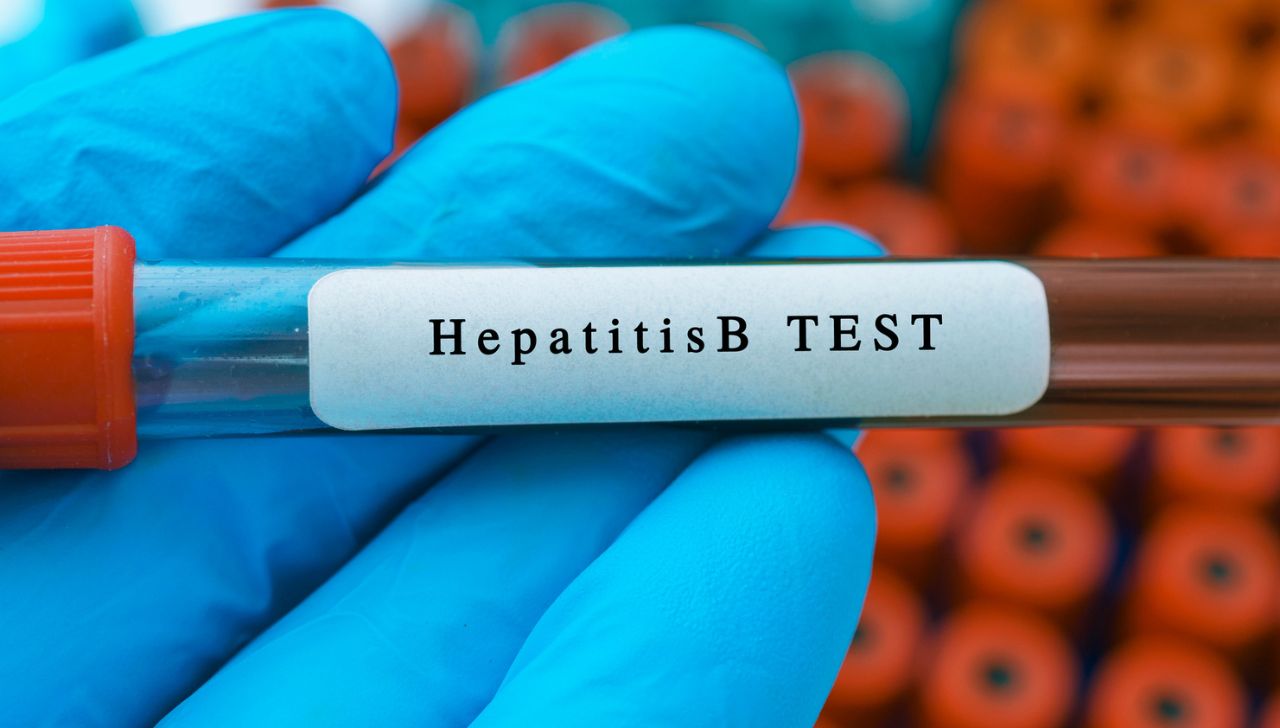 Tipos de hepatitis: ¿Qué es, cómo se contagia y cuáles son los síntomas?