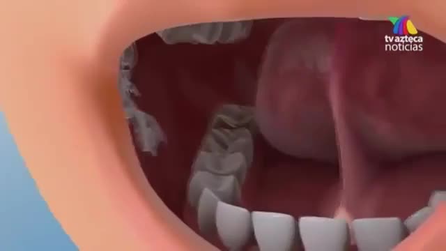 ¿Qué pasa si no producimos saliva y por qué se suministran sialogogos?