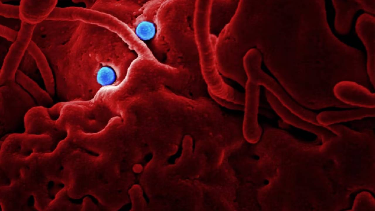 ¿Qué es el virus Alaskapox y cuáles son sus síntomas? Podría llegar a ...