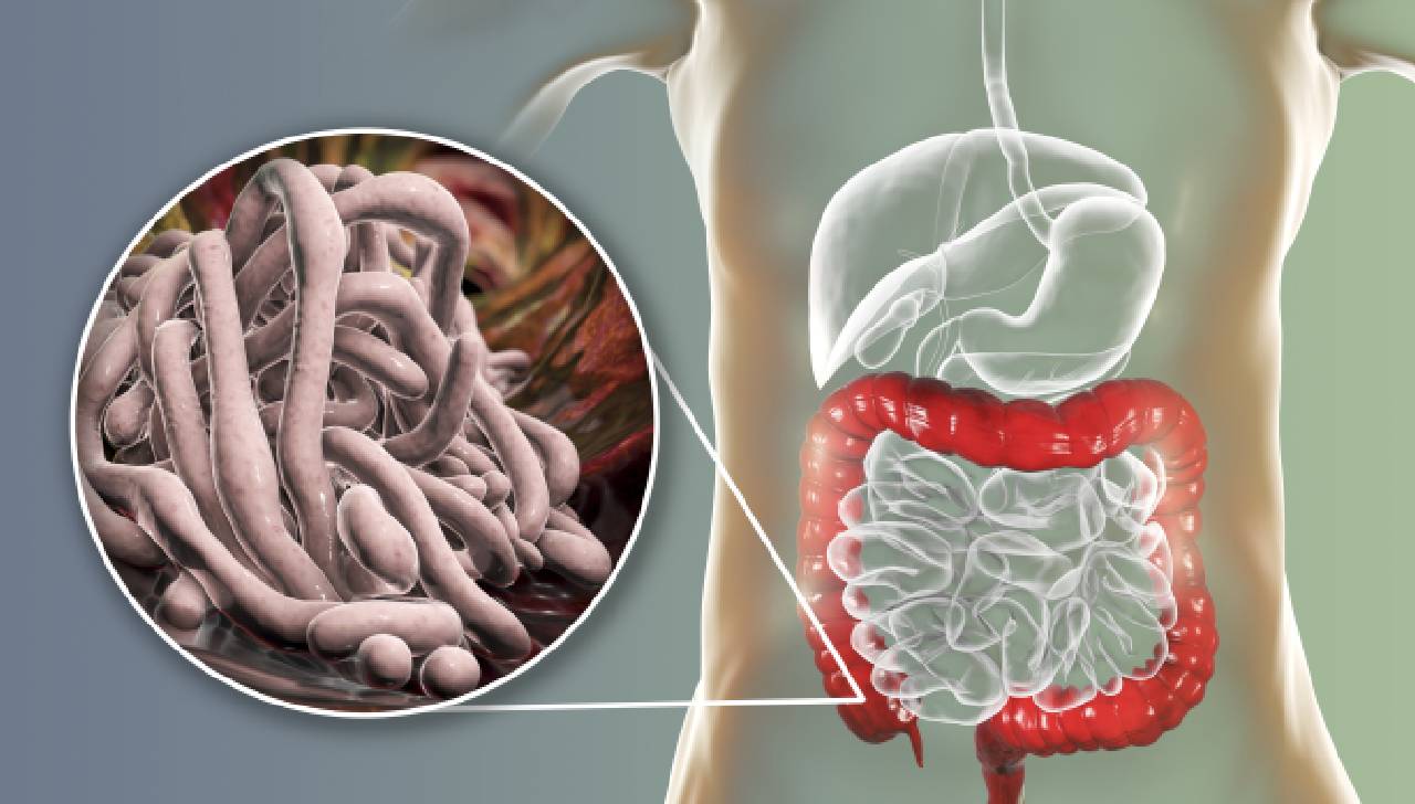 Quiénes necesitan desparasitarse y cuáles son los síntomas si no se hace