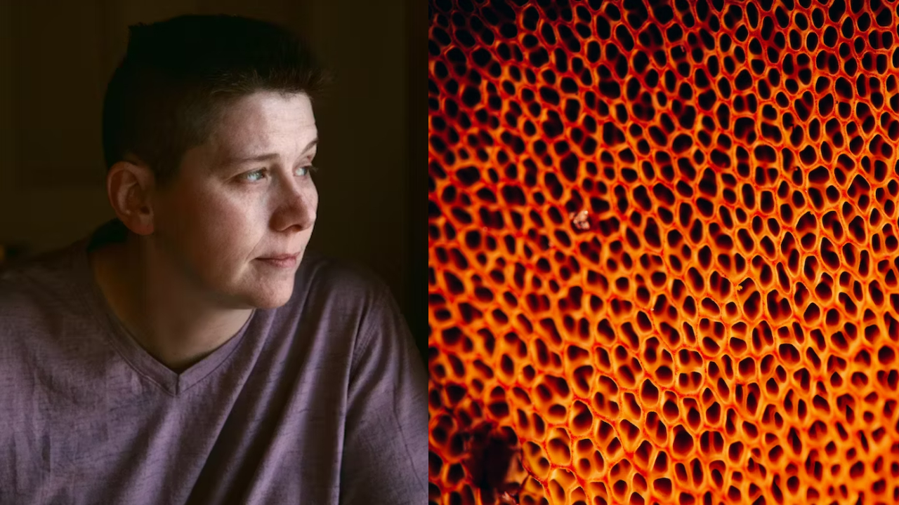 Tripofobia En Humanos