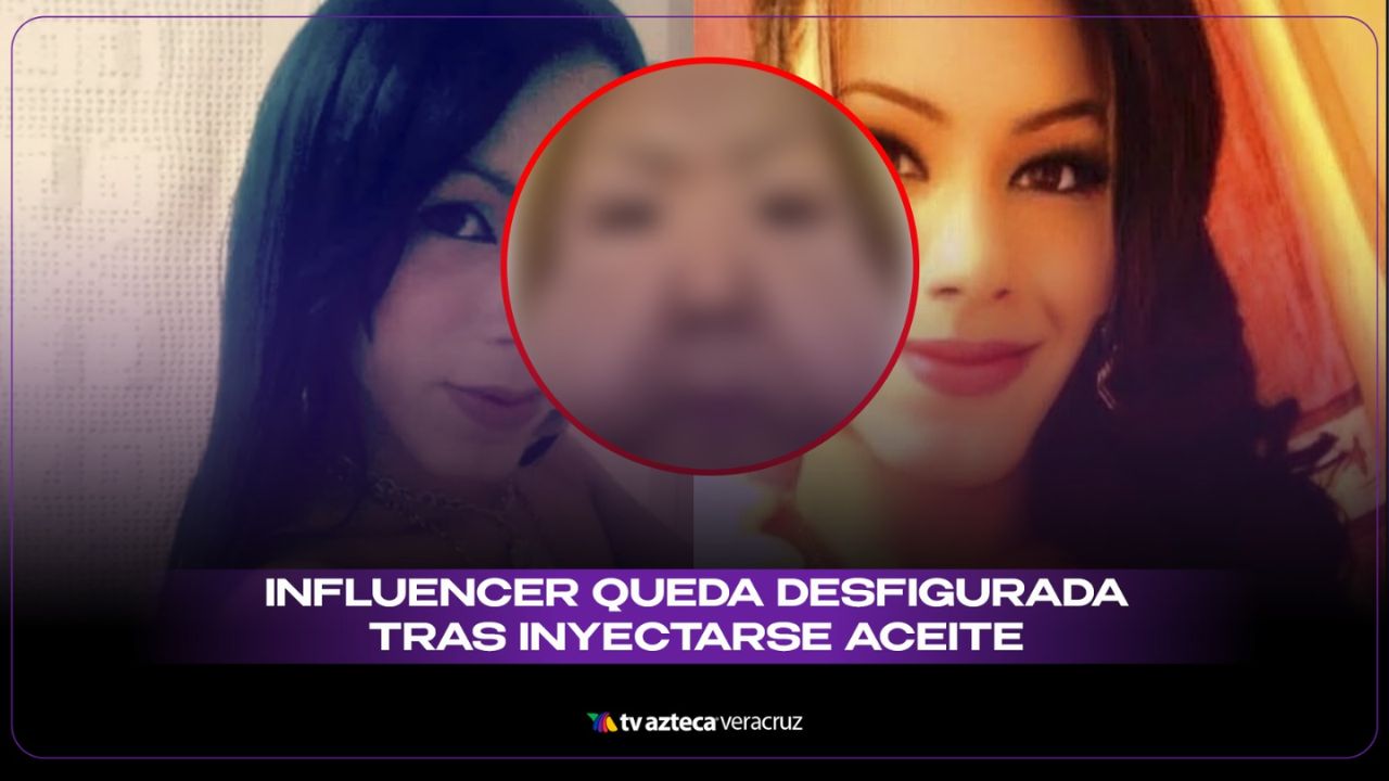 ¿Qué se sabe de Juliana Oliveira? Influencer que se inyectó aceite en ...
