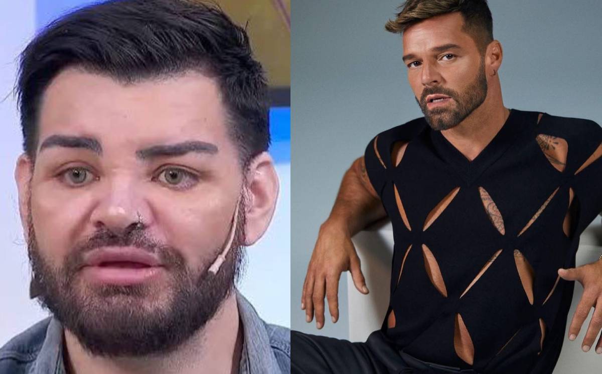 Fan de Ricky Martin se opera para parecerse a él