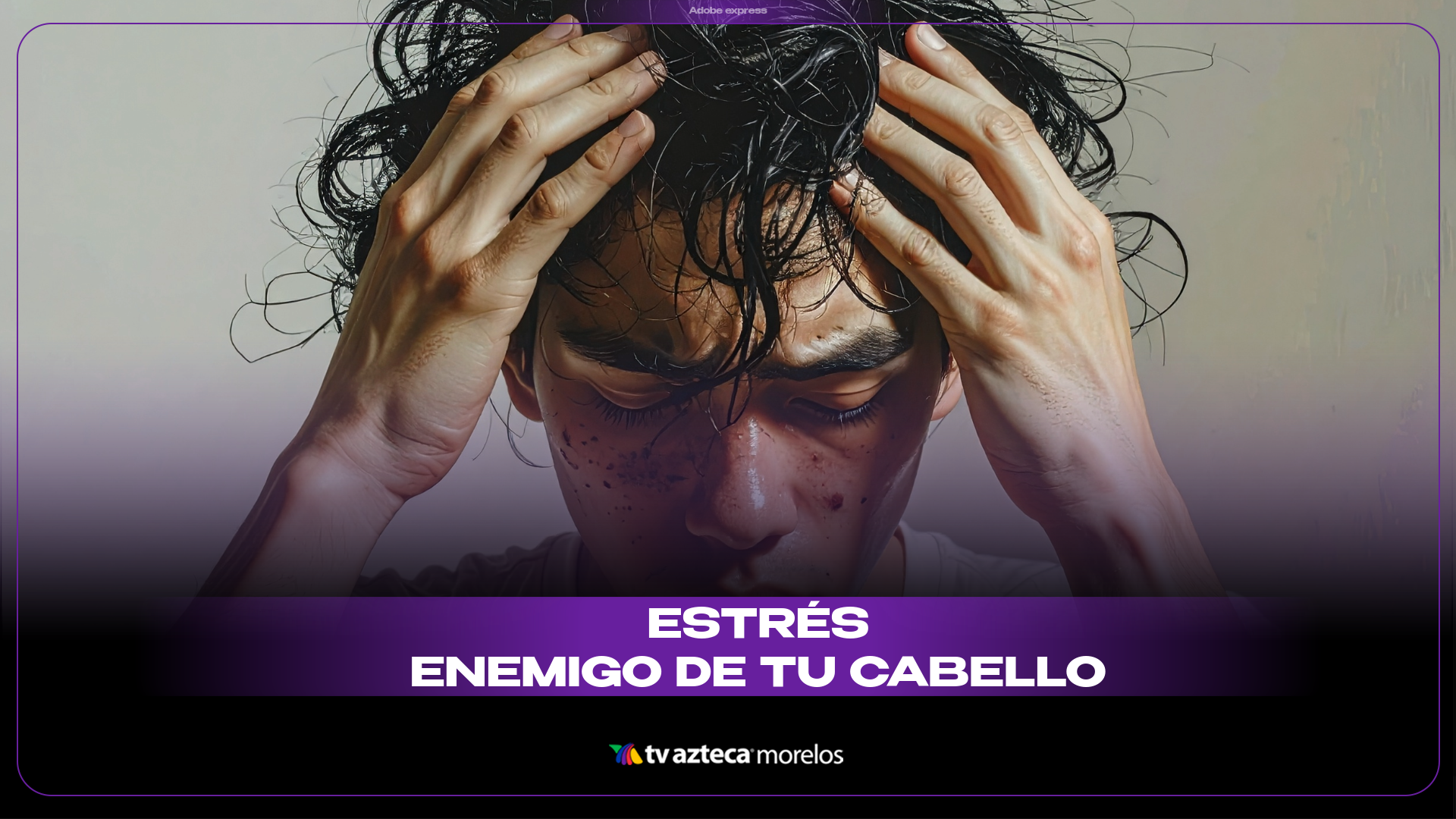 ¿Se te está cayendo el cabello? El estrés podría ser la razón del ...