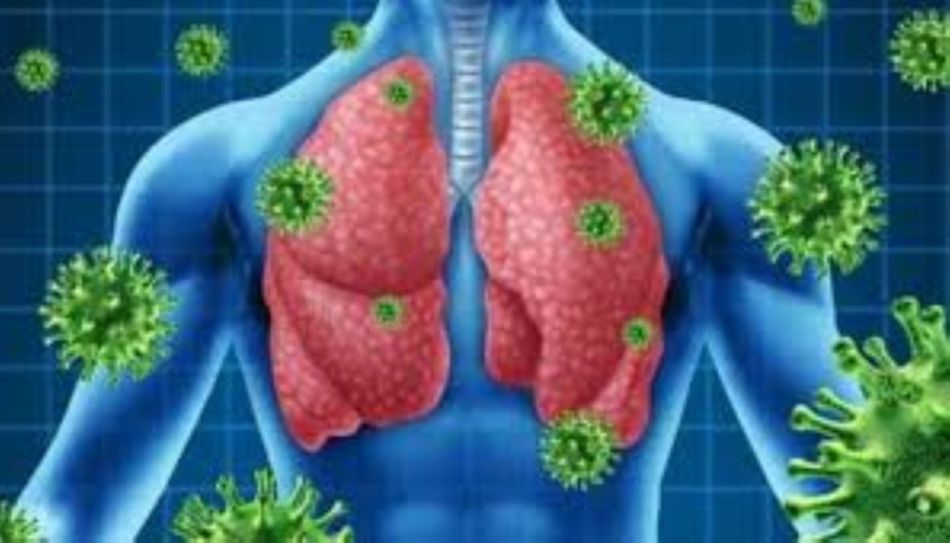 ¿Viral o Bacteriana? Descubre los tipos de infecciones respiratorias