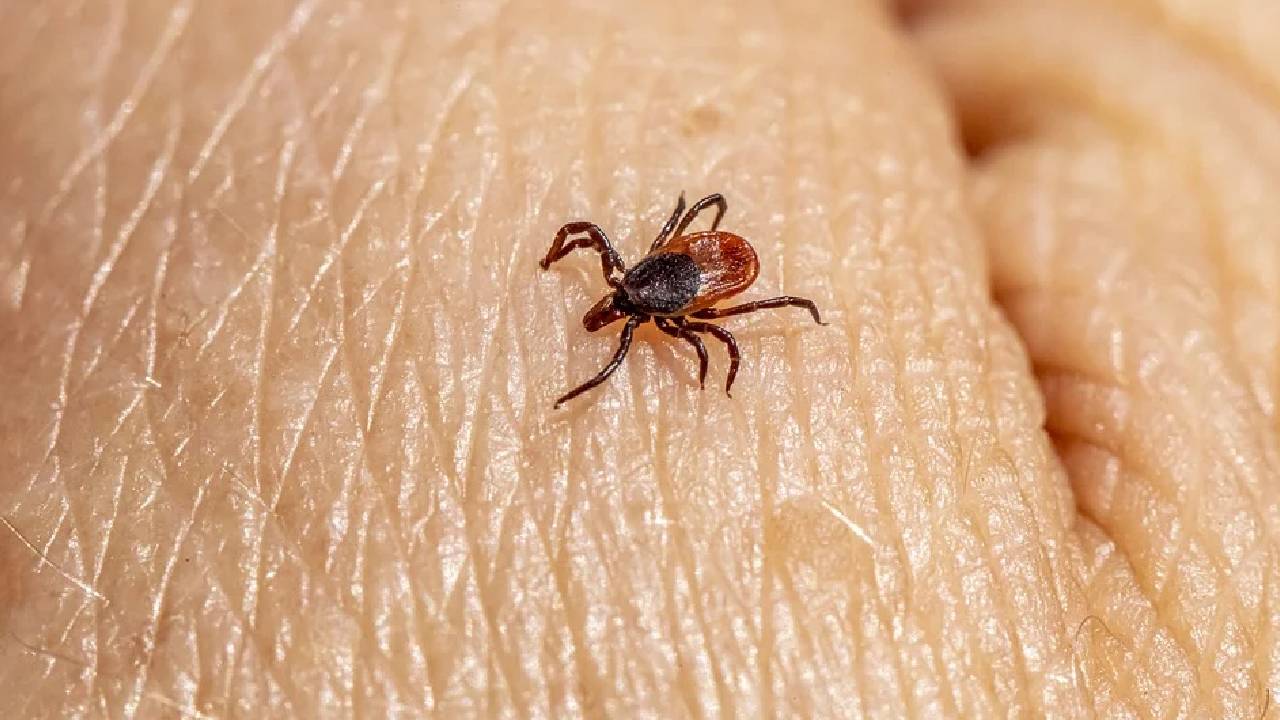 Virus Xue-Cheng: ¿Qué es, cómo se propaga y cómo prevenirlo?