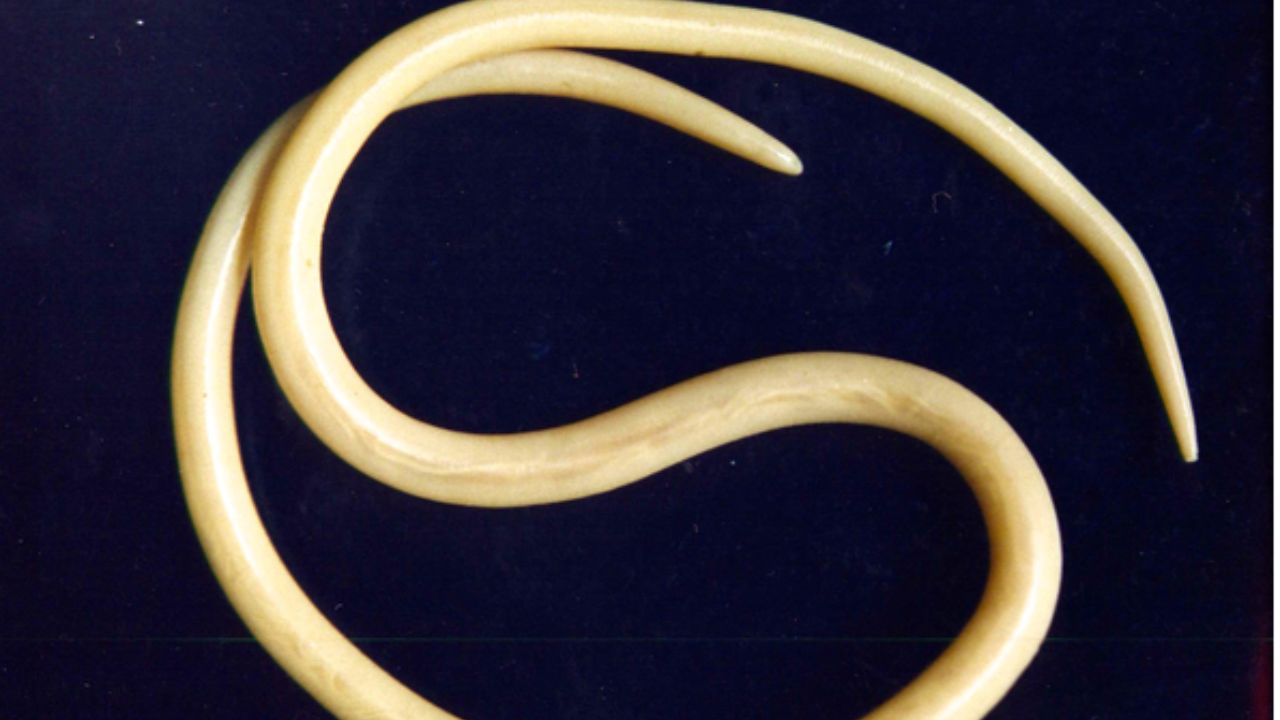 Parasitos Intestinales En Humanos