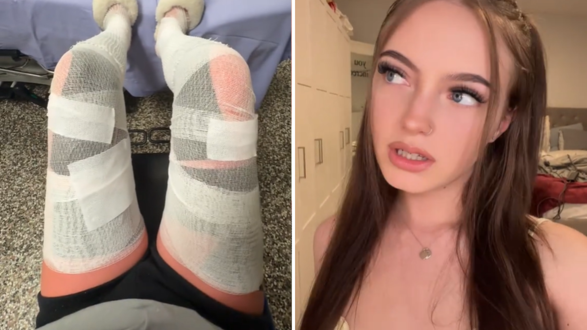 ¿Qué le pasó a Taylor Faith? Influencer sufre quemaduras y pierde movilidad tras día en la playa