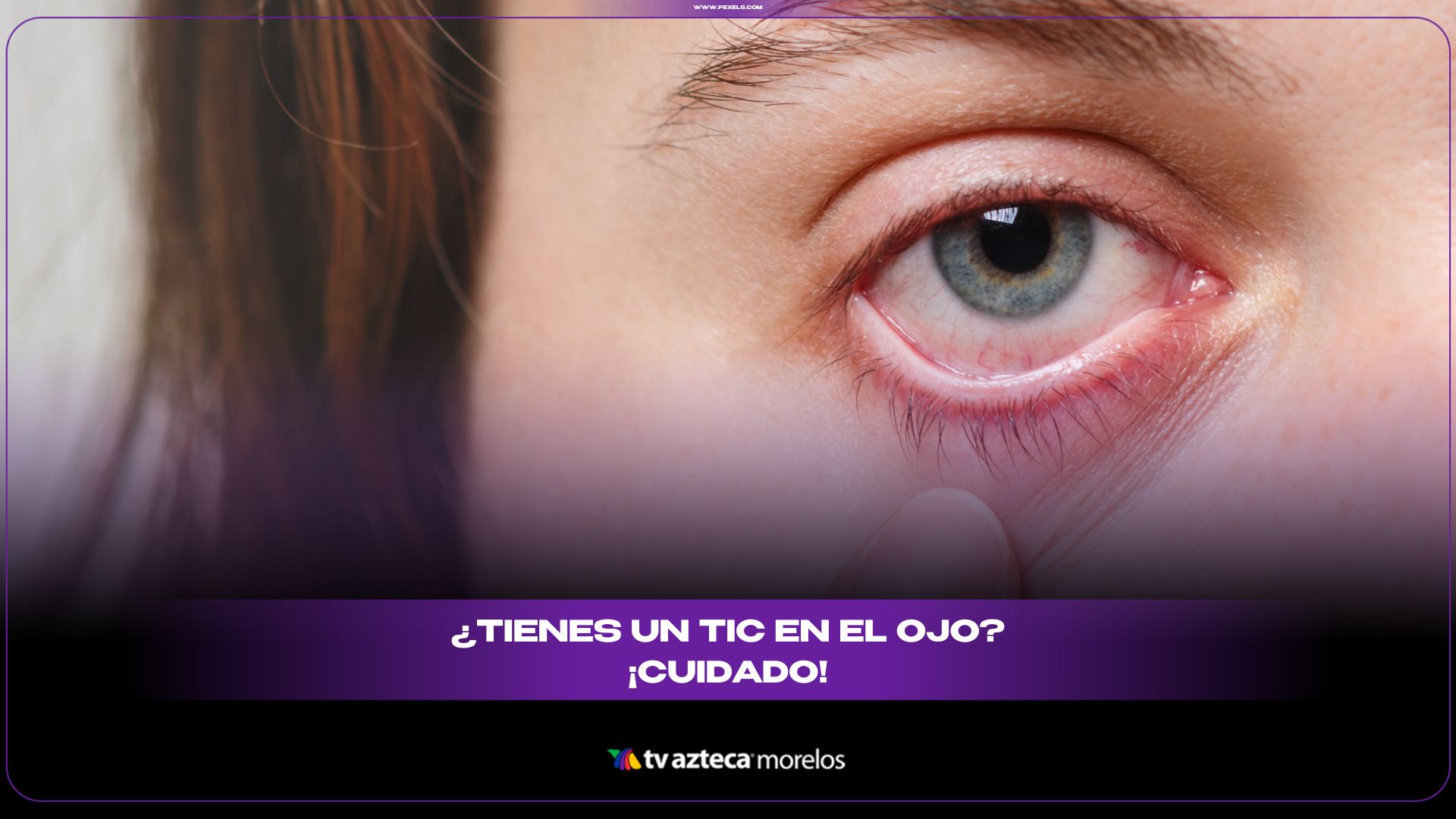 ¿Por qué me brinca el ojo sin razón?