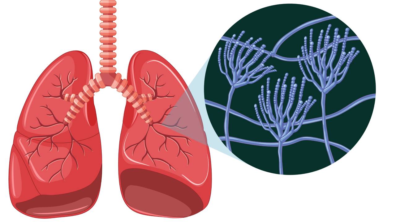 Autoridades de San Diego alertan por posible exposición a tuberculosis ...