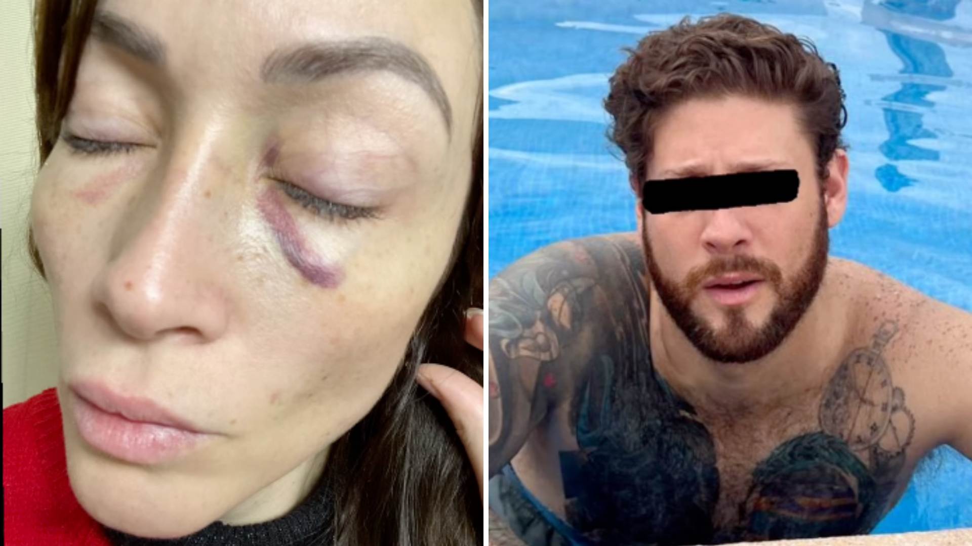 ¿Laura Vignatti expuso los golpes que le propinó su expareja?