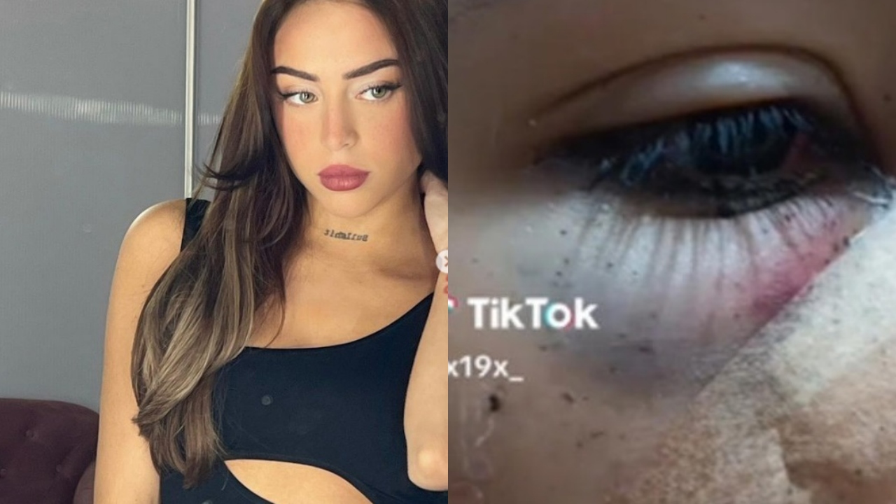 Fan expone que Nicki Nicole la mandó hospital por darle un botellazo en ...