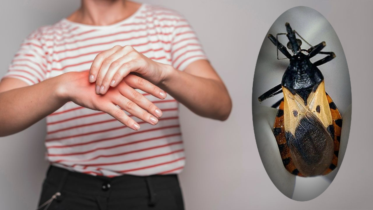 ¿Cómo identificar la chinche besucona y qué enfermedad transmite?