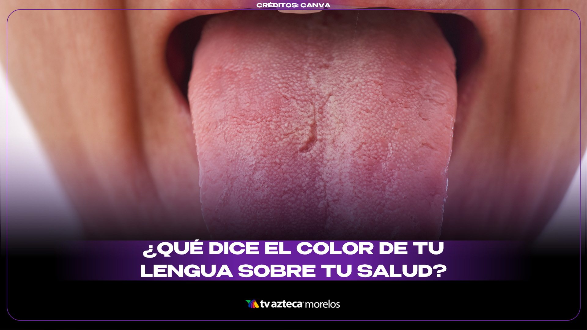 ¿Qué dice el color de tu lengua sobre tu salud?