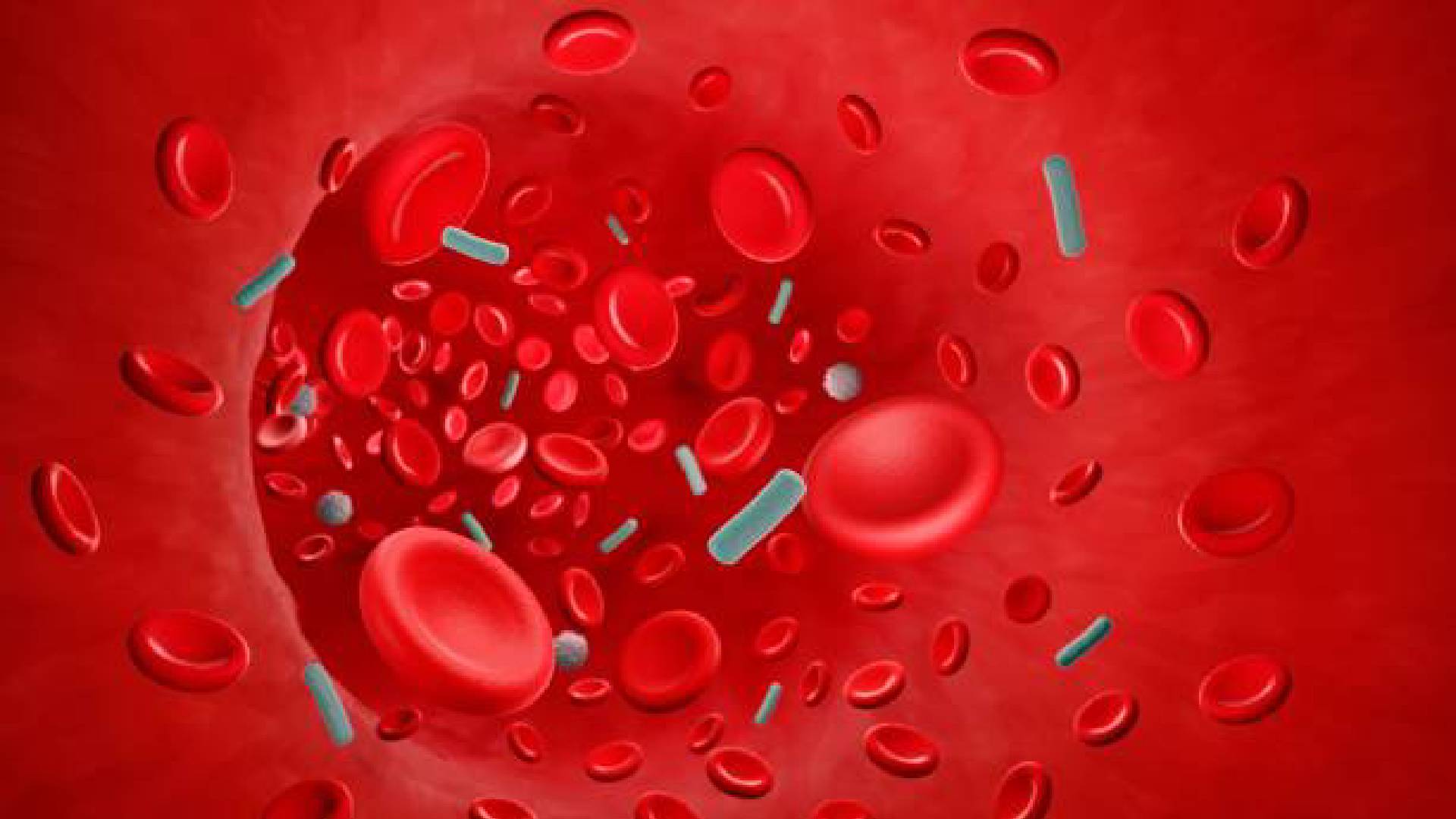 ¿Qué es la sepsis, cómo inicia y cuáles son los síntomas que pueden ...