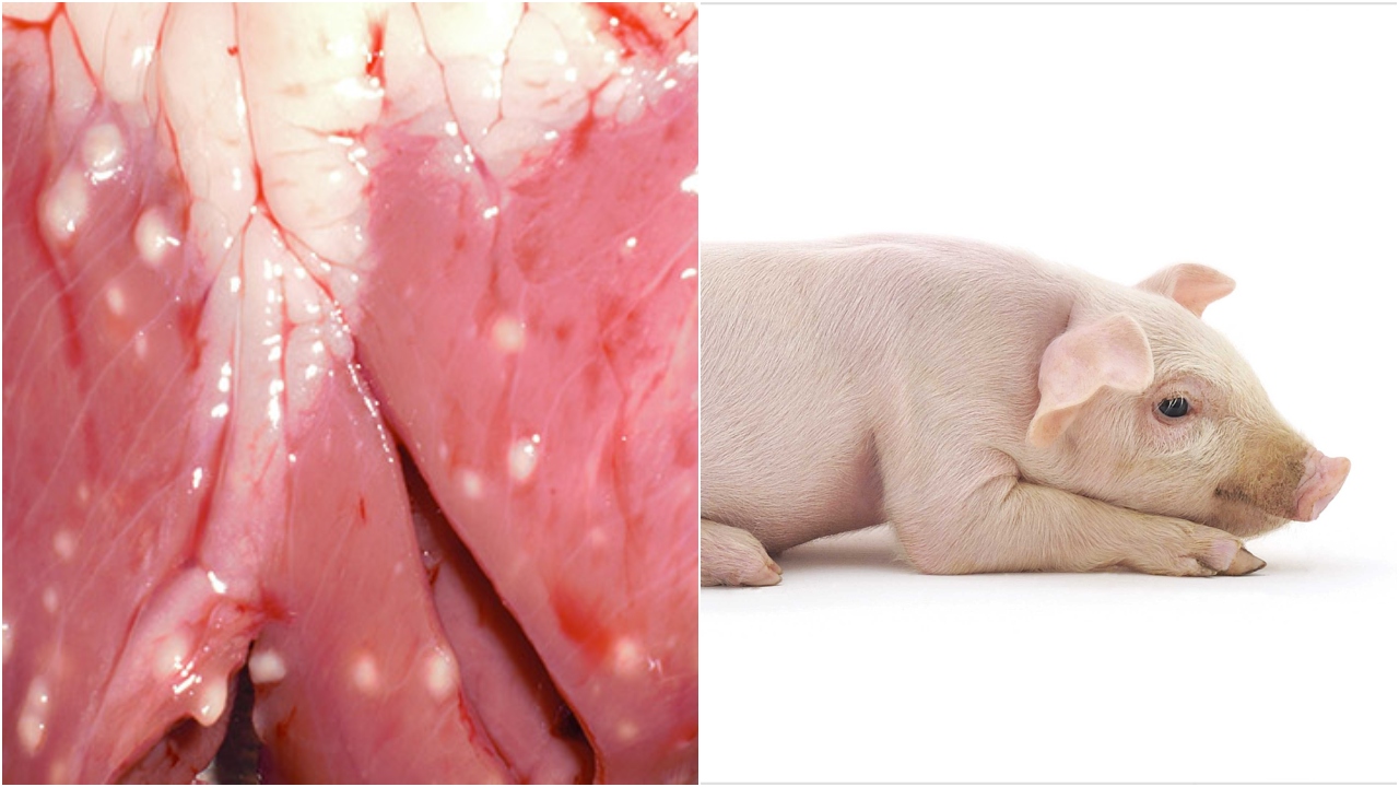 ¿Qué son los cisticercos y qué alimentos pueden tenerlo?