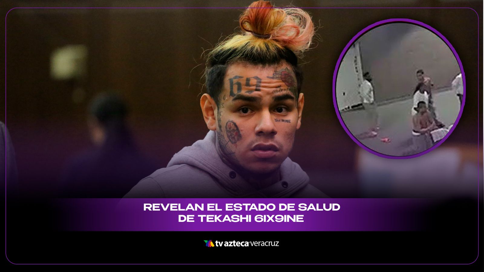 ¿Apuñalaron Tekashi 6ix9ine? Esto se sabe