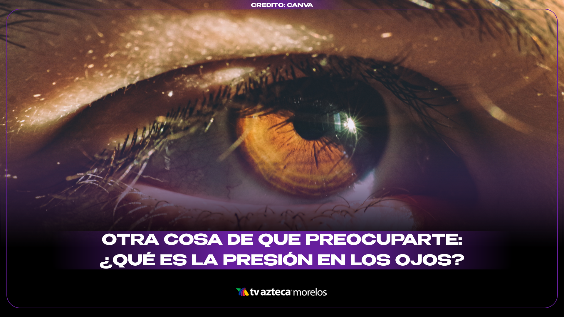 ¿Qué es la presión intraocular y cómo debemos de cuidarla?