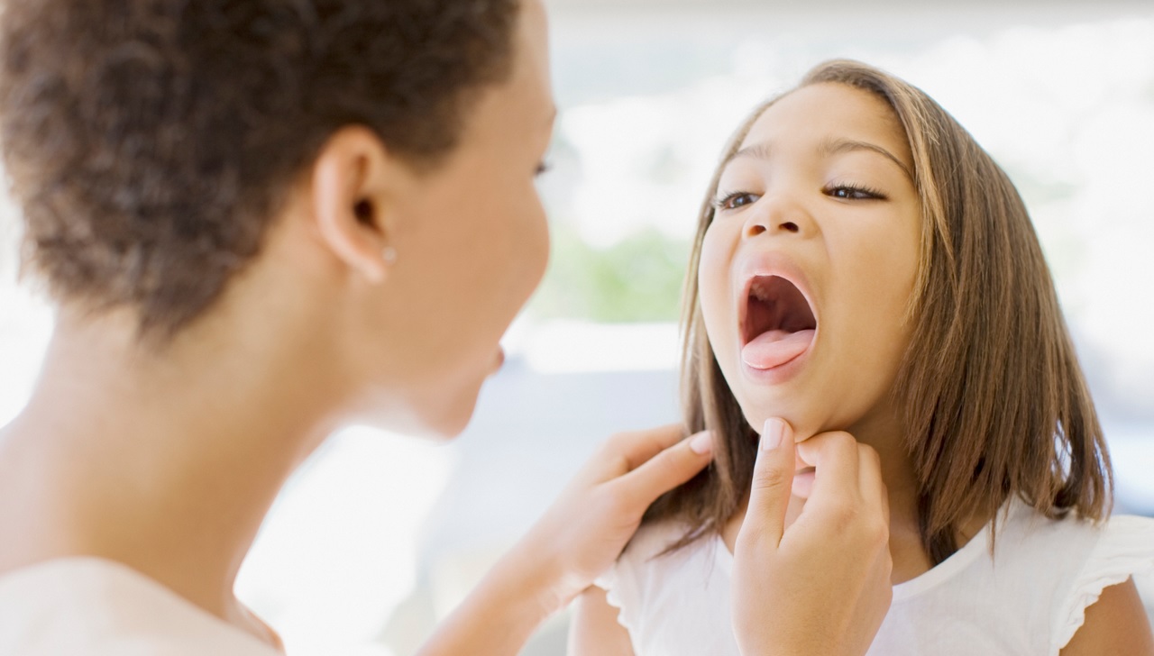¿Qué es la escarlatina y cómo se ve una lengua escarlata?