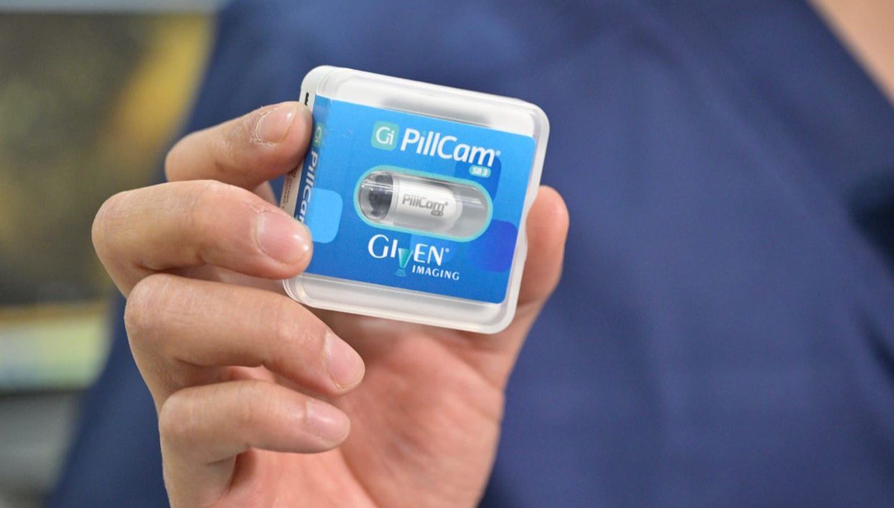 ¿Cómo funciona la cápsula endoscópica del IMSS?