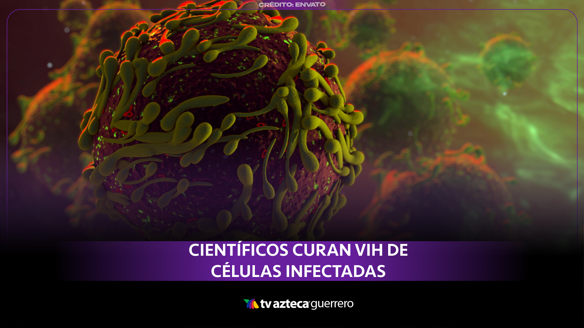 Científicos logran eliminar el VIH de células infectadas