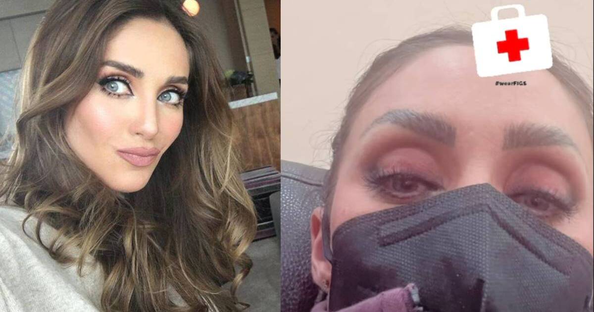 Anahí se perfora el tímpano tras accidente
