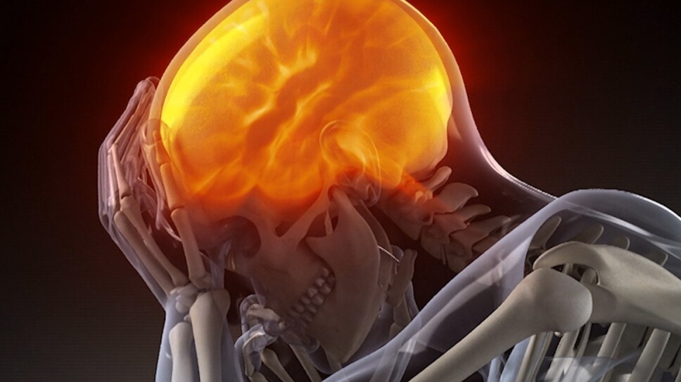 Así Afecta Tu Cerebro El Consumo De Drogas
