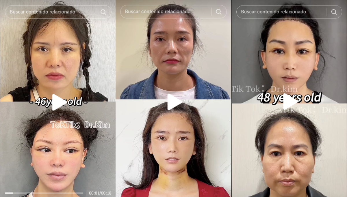 Dr Kim, el cirujano plástico que es el terror de TikTok por sus operaciones