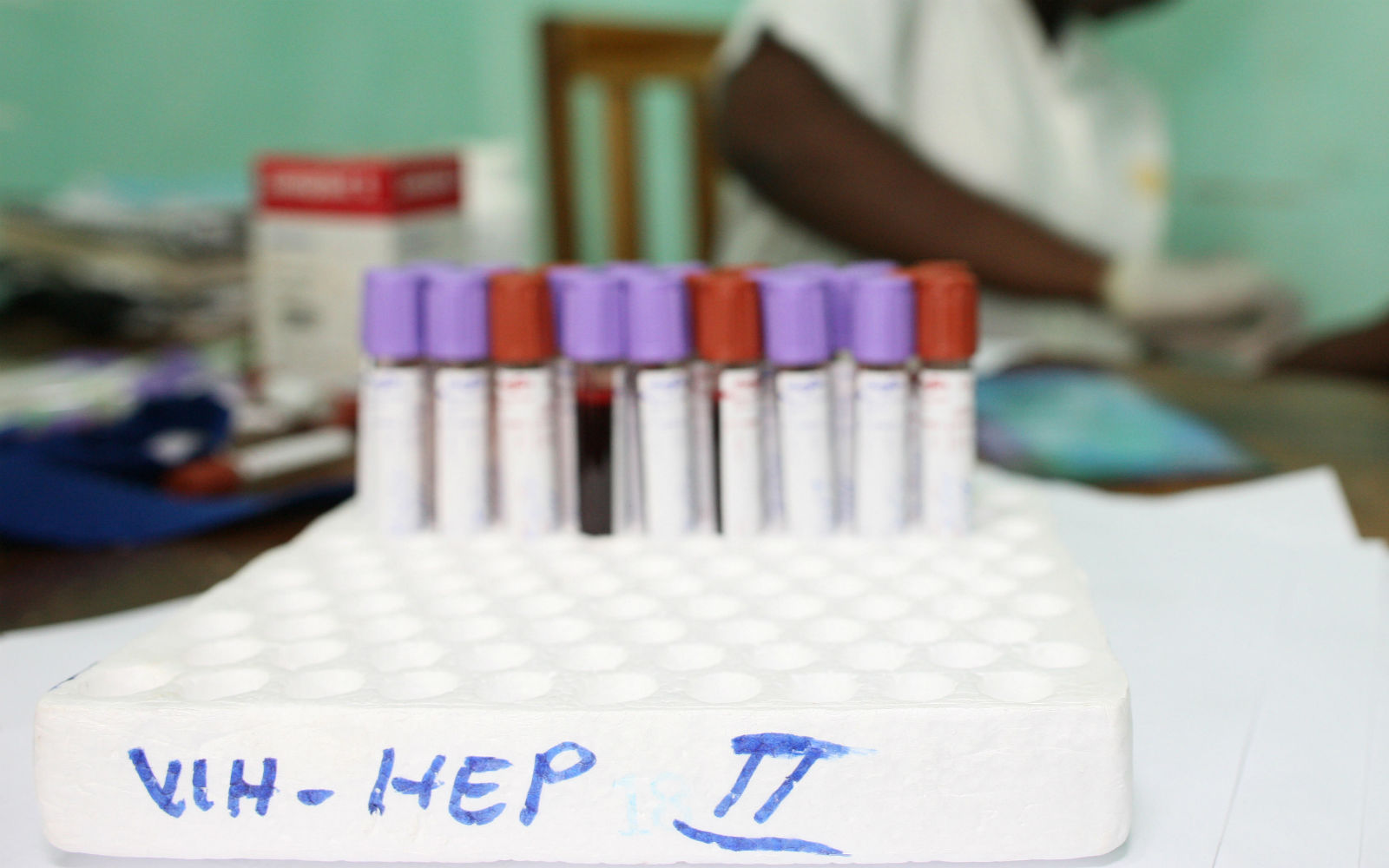 Nuevos casos de VIH en México: estados más afectados del país