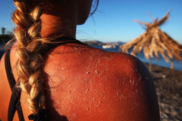 Rayos UV en Yucatán: Advierten niveles altos para hoy, domingo 14 de junio