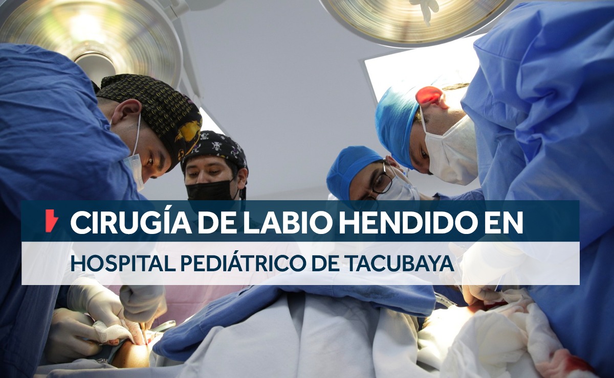 CDMX: Cirugía de labio hendido en el Hospital Pediátrico de Tacubaya