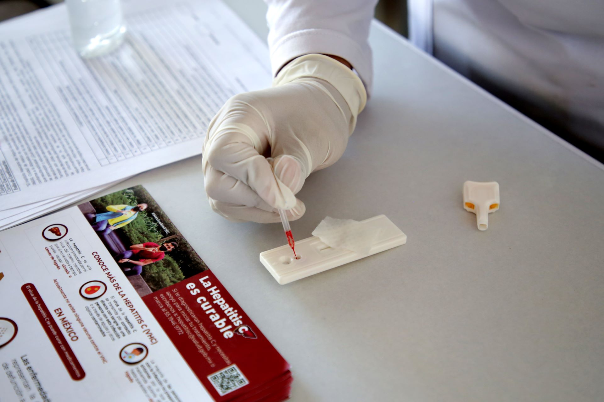 detecciones de hepatitis tipo C